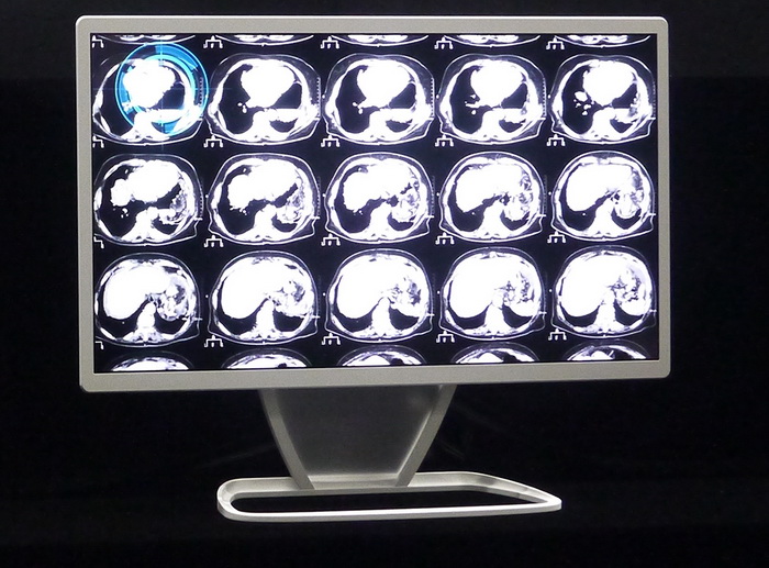 日本JOLED宣布世界首款RGB印刷工艺的OLED面板