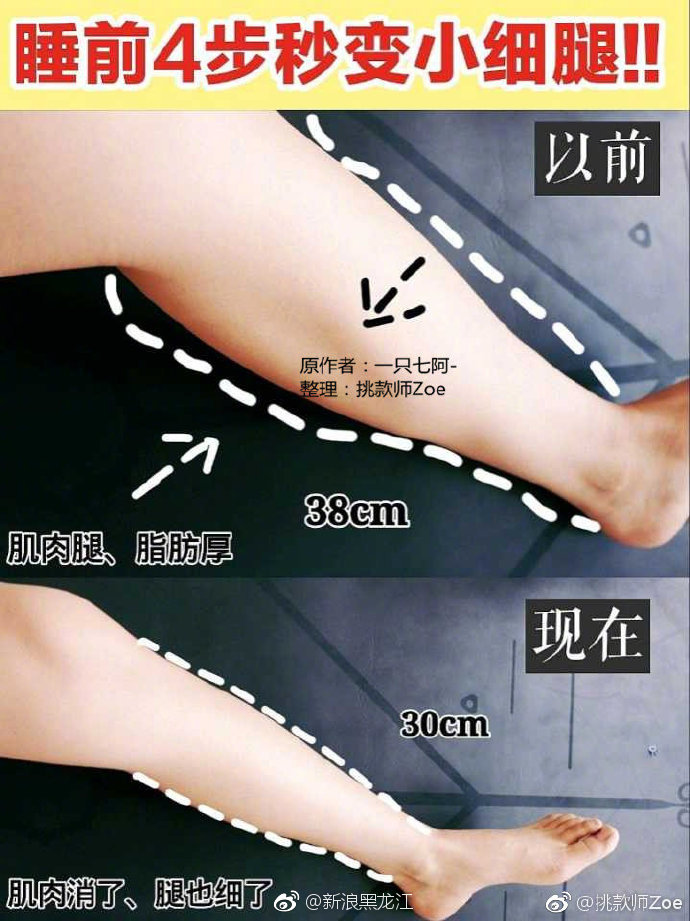 如何判断自己是肌肉腿,还是脂肪腿脂肪肌肉刮痧新浪新闻