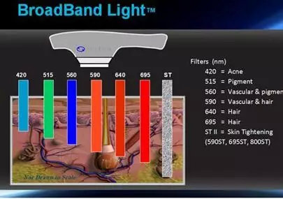 IPL、 OPT、 AOPT、 DPL、 ATP、 BBL都是光子嫩肤简称?有何不同？|脉冲光|临床|嫩肤_新浪新闻