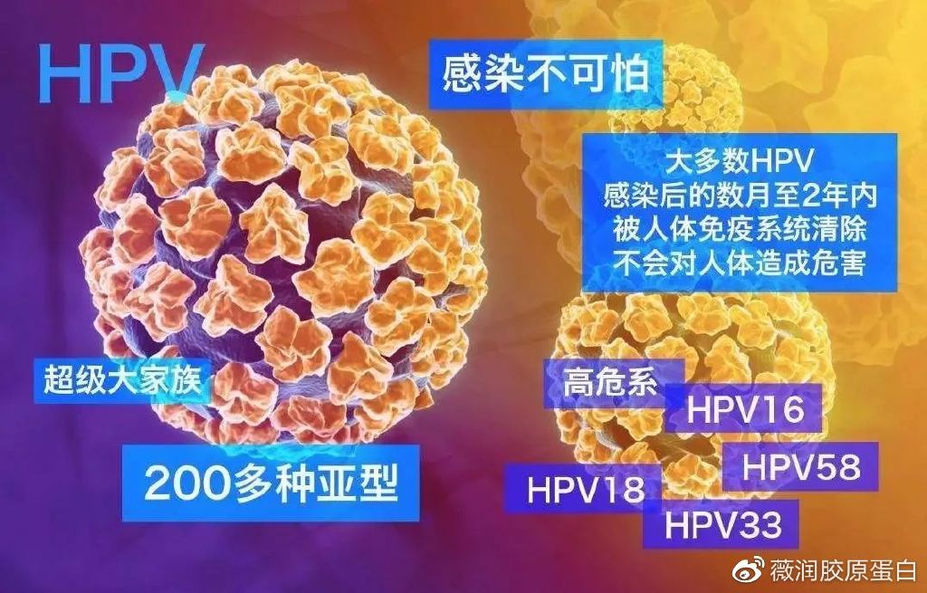 国际HPV知晓日：感染HPV怎么办？HPV能治愈吗？本文带你了解HPV知识