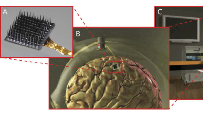 BrainGate发布植入神经接口系统临床试验的安全记录结果|脊髓损伤|参与者|阵列_新浪新闻