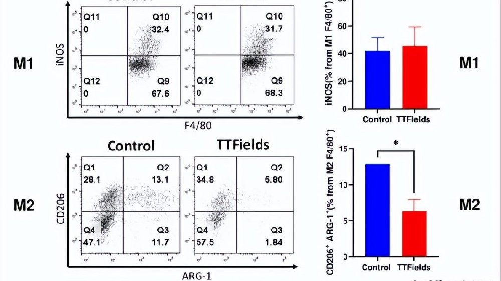 肿瘤电场治疗（TTFields）可调节巨噬细胞向促炎表型转变|抗癌|巨噬细胞|表型_新浪新闻