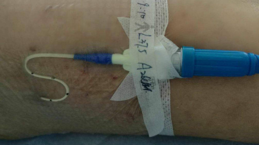 PICC导管堵塞了就必须要拔除吗？不妨来试试这几个方法~|血栓|注射器_新浪新闻