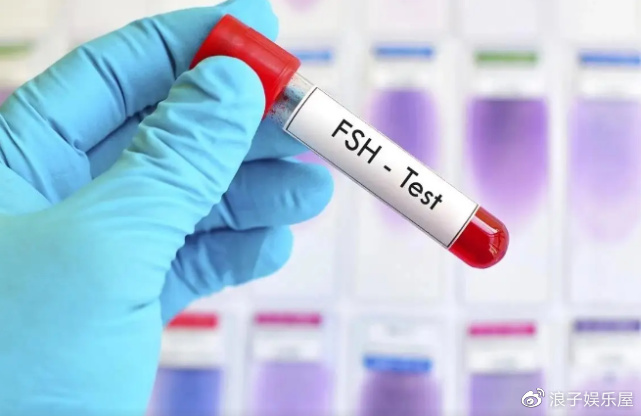 dhea可以降fsh吗？多囊卵巢综合症lh fsh，且浅分析一下