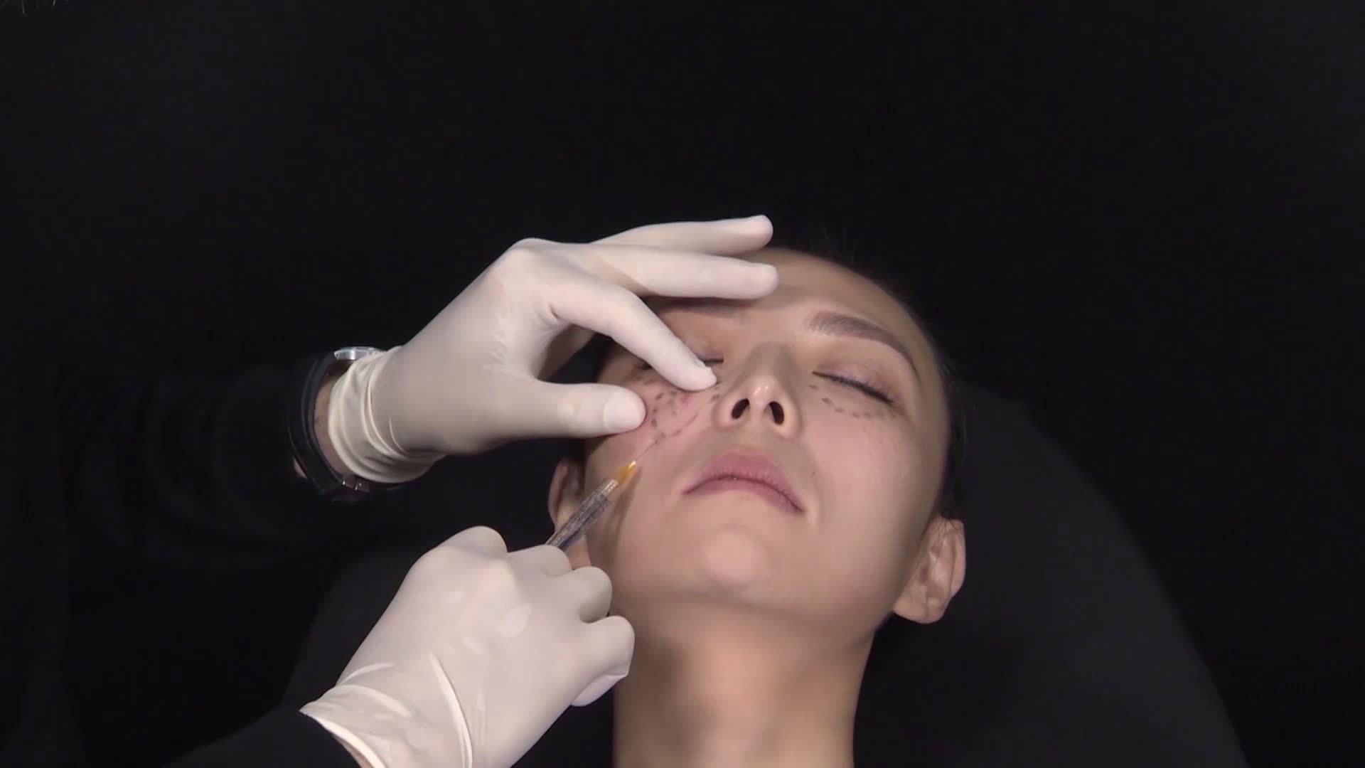 世界级整形大师Mauricio de Maio的现场注射教学…………_新浪新闻