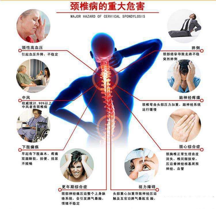 颈椎病多致命?颈椎不好的人一定要看!颈椎病颈椎新浪新闻