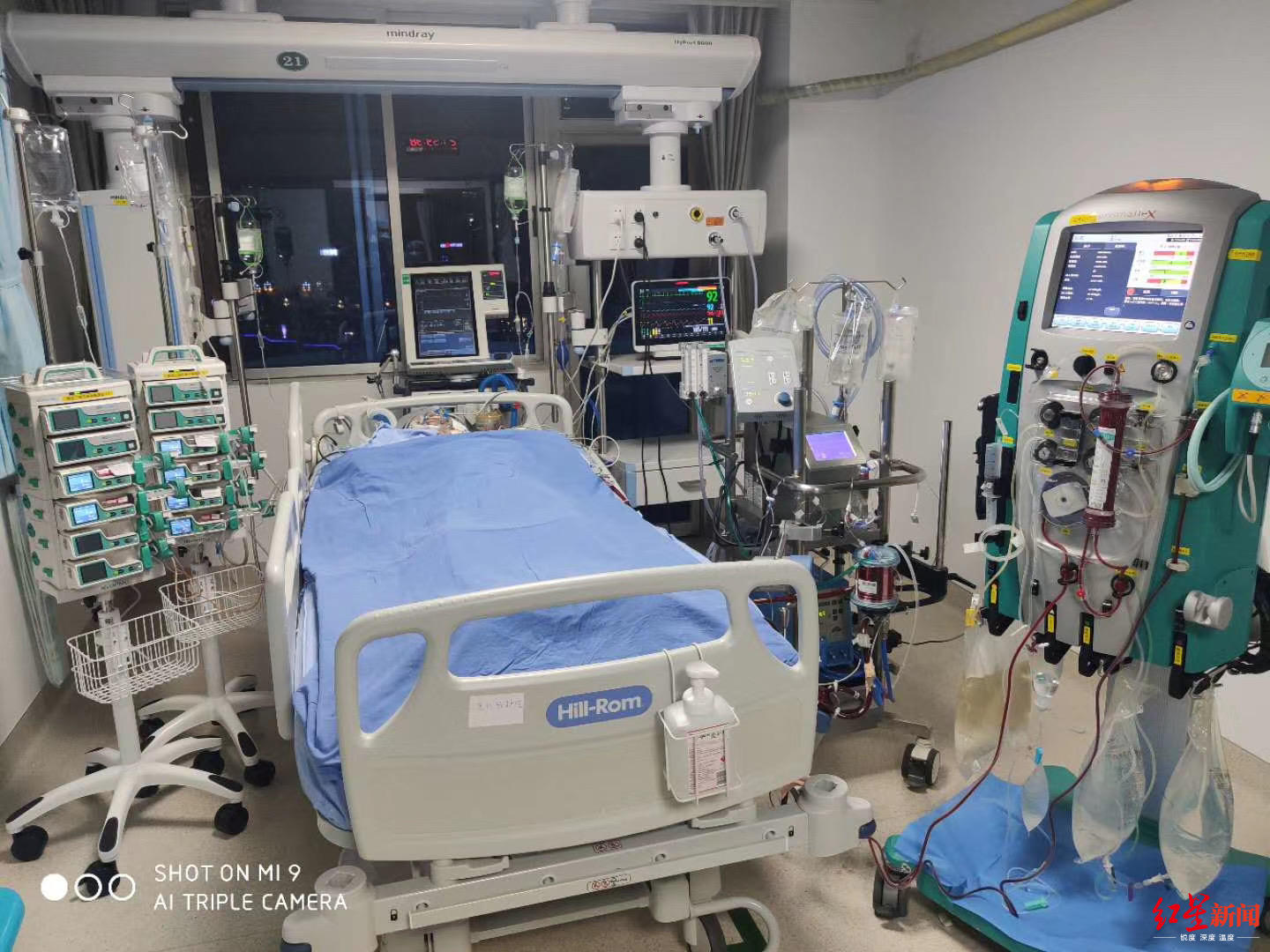 全国仅400余台 四川德阳首次用这个“救命神器”抢救危重患者|ECMO_新浪新闻