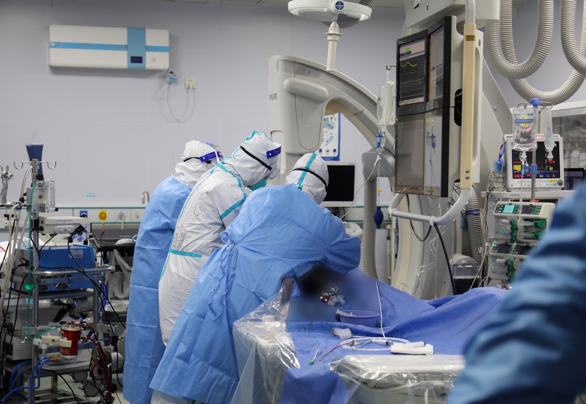 全国首例标准二级防护下ECMO支持的急诊TAVR手术成功开展|心衰|疫情|手术_新浪新闻