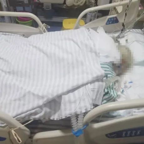 老人宰了两只鸭子后被送进ICU，这种病要警惕！|感染|发热|咳嗽_新浪新闻