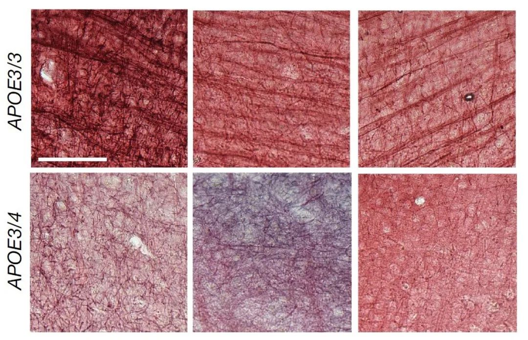 Nature：MIT蔡立慧团队系统研究APOE4对不同脑细胞产生的影响
