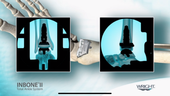 学科精细化促骨科发展迈入新时代_手机新浪网