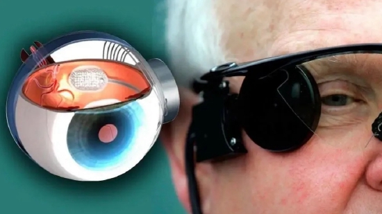 双语热点：仿生眼技术旨在帮助盲人重见光明_手机新浪网