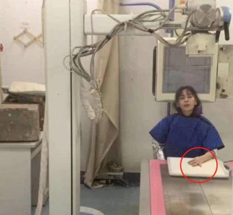 Angelababy烟瘾太大，医院换药时不忘抽烟，吞云吐雾手势娴熟|吸烟|烟瘾|女明星_新浪新闻