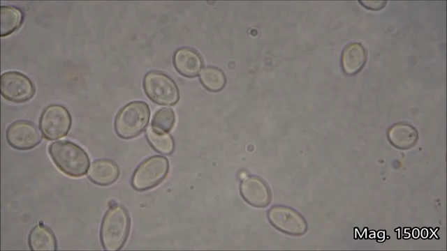 显微镜下的世界：酵母菌（10倍-1600倍）|酵母菌|显微镜_新浪新闻