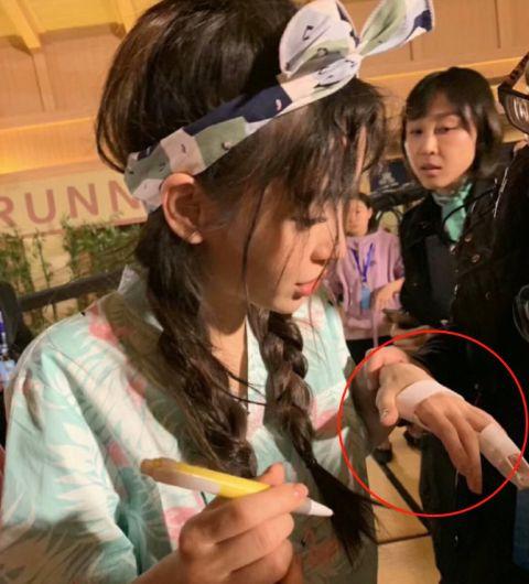 Angelababy烟瘾太大，医院换药时不忘抽烟，吞云吐雾手势娴熟|吸烟|烟瘾|女明星_新浪新闻