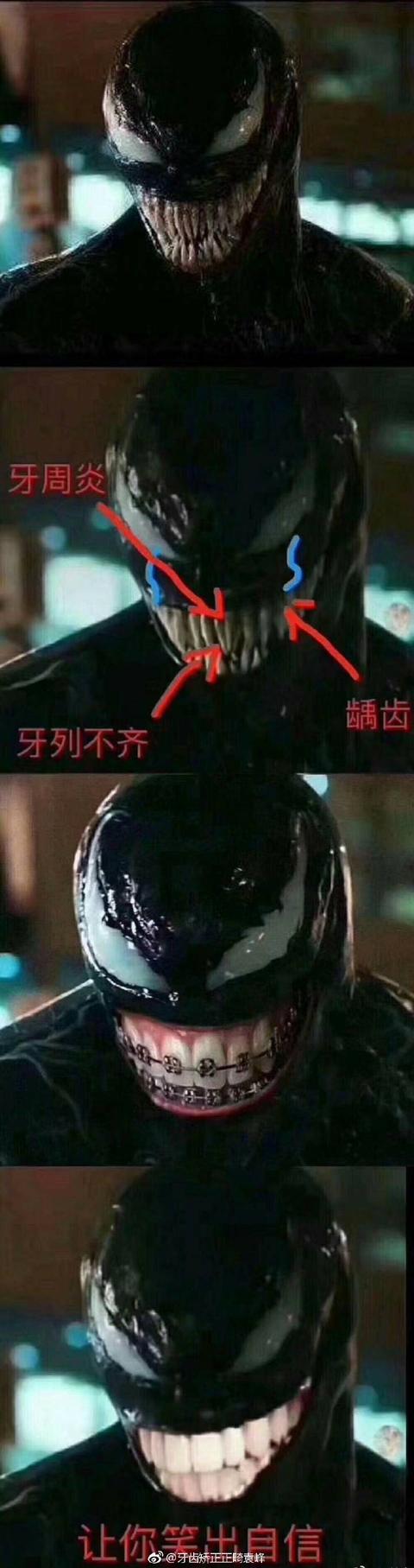 求新鲜出炉的毒液表情包 让你笑出自信|图片来源|毒液|表情包_新浪新闻