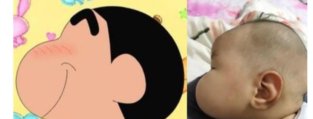 现实中竟真有，蜡笔小新的嘴巴嘟嘟脸！灵感来源于生活，真没错|蜡笔小新|嘴巴|灵感_新浪新闻