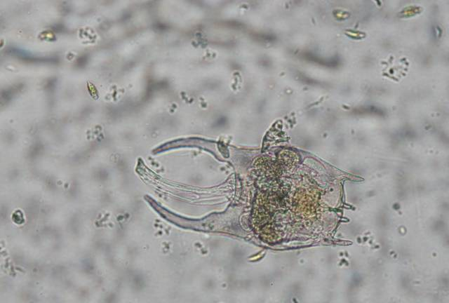 小水体，大世界--显微镜下的浮游生物，值得一看|轮虫|衣藻|伸缩_新浪新闻