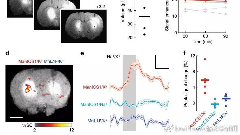 Nature：新型MRI造影剂助力更精确的神经元活动的空间和时间定位|细胞|造影剂|神经元_新浪新闻