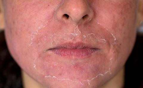 糖尿病会引起肾衰竭吗？出现这5种情况，就要提高警惕了|肾脏|肾衰竭|病变_新浪新闻