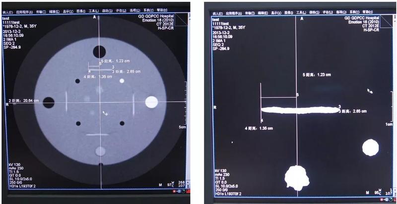 【专业】医疗机构使用的CT检测揭秘|CT_新浪新闻