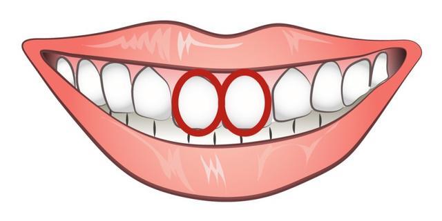 心理测试：4种门牙，你是哪种？测你这辈子缺不缺钱花？准爆了|经济问题|门牙|心理测试_新浪新闻