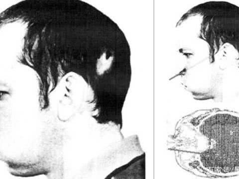 若人的头部被高速运动的粒子击中会怎样？被撞击部位衰老速度减缓|控制台|粒子|加速器_新浪新闻