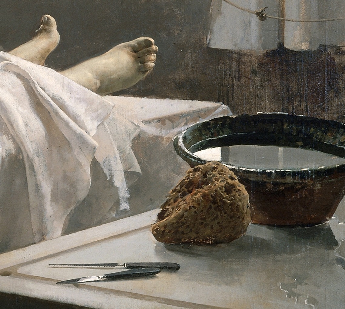 La autopsia / Anatomía del corazón / ¡Y tenía corazón