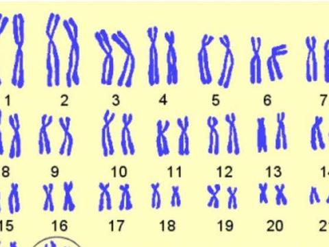 第三代试管婴儿5对染色体和23对染色体检查的区别|染色体|筛查|胚胎_新浪新闻