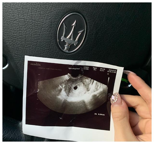 Mystic老婆微博晒自拍“秀恩爱”，网友：糖小幽？__财经头条