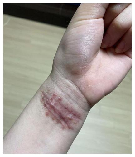 权珉娥疑似三度割腕自杀：我要幸福的走，这里太痛苦了财经头条 6031