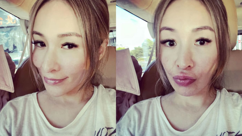 不遮了！萧亚轩素颜“狗咬伤右脸”疤痕现形|萧亚轩|素颜|疤痕_新浪新闻