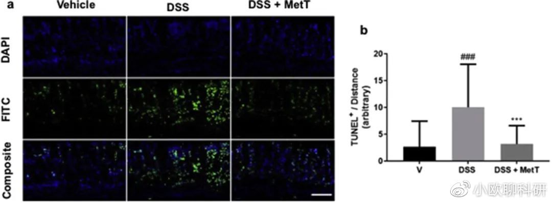 空间代谢组学技术助力炎症性肠炎疗法开发新策略|结肠炎|对照组|小鼠_新浪新闻