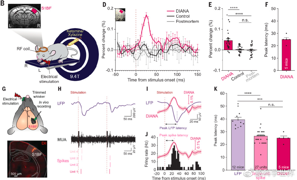 Science重磅研究：高时空分辨率的MRI成像__财经头条