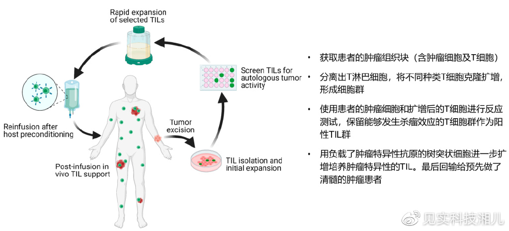 TIL疗法3期数据首发布，显著延长晚期实体瘤患者PFS