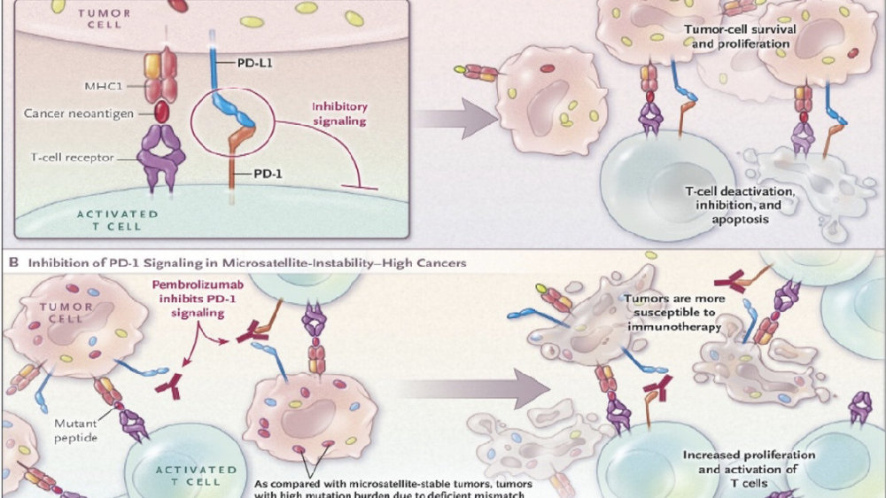 MSI/MMR与妇科肿瘤免疫治疗|子宫内膜癌|免疫|肿瘤_新浪新闻