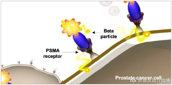 晚期前列腺癌新疗法！创新靶向放射配体疗法Pluvicto获批__财经头条