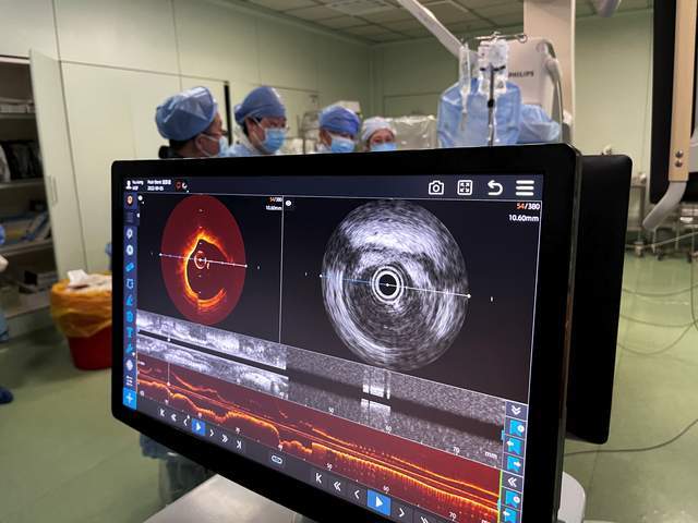 我学者研制出IVUS-OCT一体机，两项血管内影像检查一步完成__财经头条