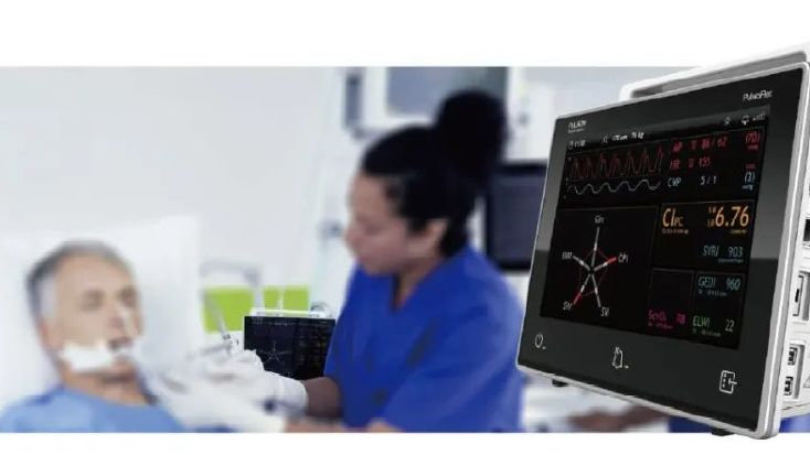 PICCO的各项参数意义，您都知道吗？|血管_新浪新闻