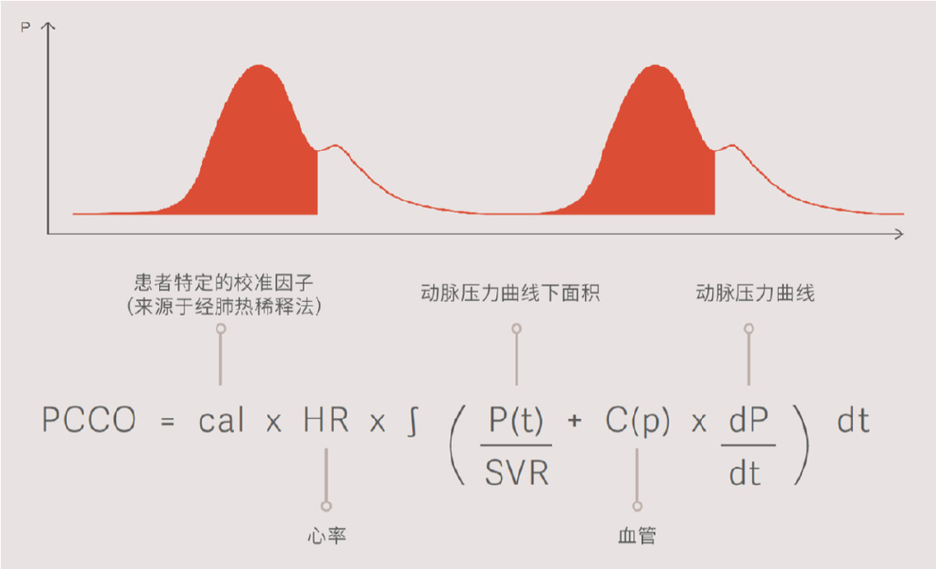 PICCO的各项参数意义，您都知道吗？__财经头条