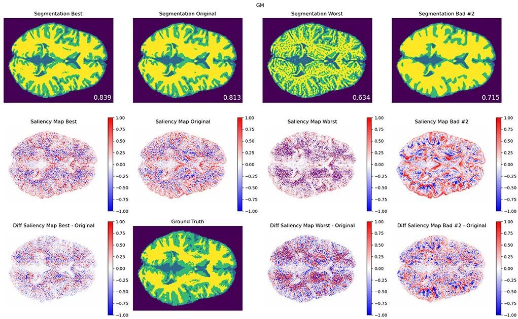 Frontiers in Neuroimaging：神经影像数据分析技术最新进展__财经头条