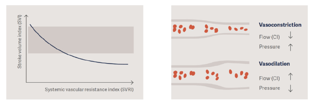 PICCO的各项参数意义，您都知道吗？__财经头条