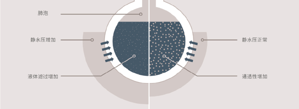 PICCO的各项参数意义，您都知道吗？__财经头条