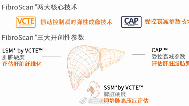 FibroScan® 是什么检查设备？|肝脏|设备_新浪新闻