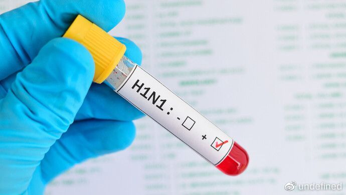 俄罗斯全境均出现甲型H1N1！什么症状？|H1N1|甲型|流感_新浪新闻