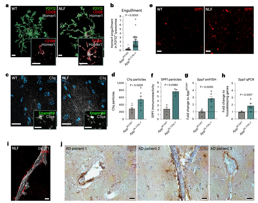 Nat Neurosci：血管周细胞调节小胶质细胞吞噬功能诱导AD的机制