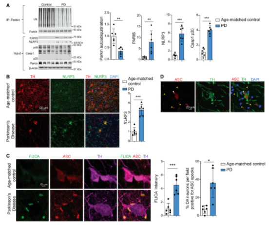 Neuron：神经元NLRP3是帕金森病中驱动神经退变的Parkin底物|神经元|小鼠|底物_新浪新闻