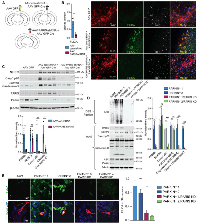 Neuron：神经元NLRP3是帕金森病中驱动神经退变的Parkin底物|神经元|小鼠|底物_新浪新闻