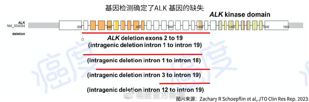 一个你从未见到的ALK基因突变类型，靶向治疗23个月|靶向|基因突变|基因_新浪新闻