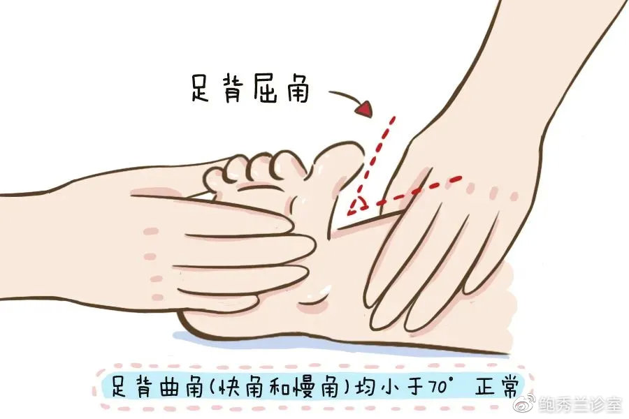 为何宝宝肌张力偏高？如何准确判断？